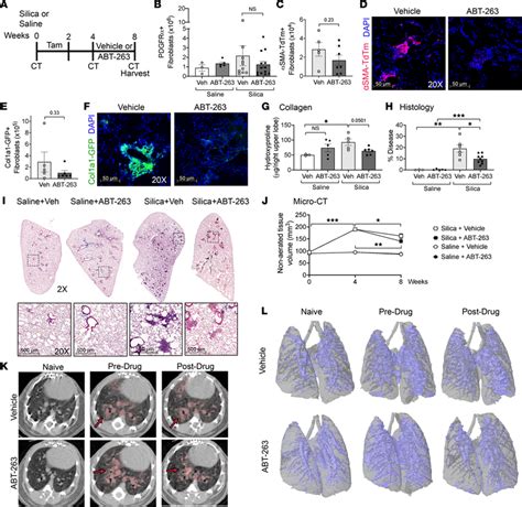 Abt 263 Reduces Fibrotic Fibroblasts In Silicotic Nodules And Reverses