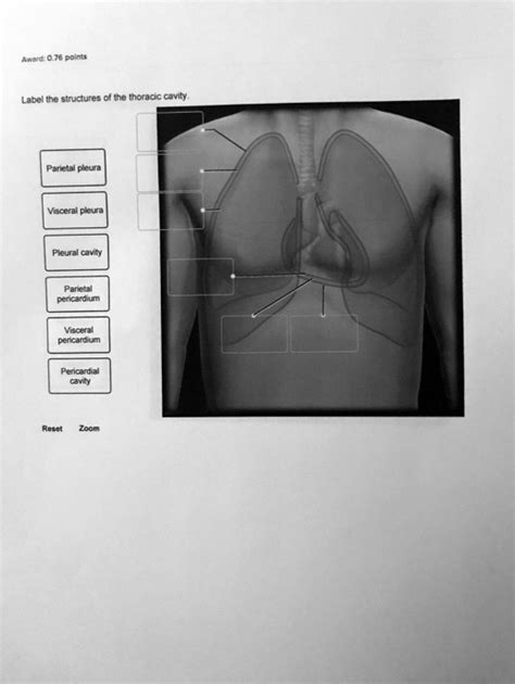 SOLVED Anatomy 101 Structures Of The Thoracic Cavity Label The
