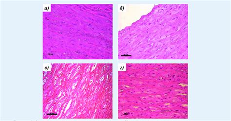 Structure Of Native Extracellular Matrix After A 50 Day Treatment
