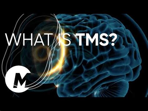 What Is TMS How Does TMS Work MagVenture TMS Therapy U Flow Crafty