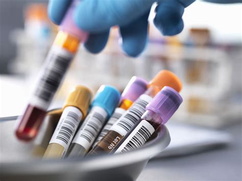 How Gluten Sensitivity Is Diagnosed