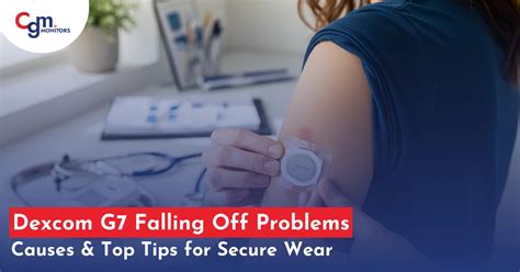 Dexcom G7 Falling Off Problems And Top Tips For Secure Wear
