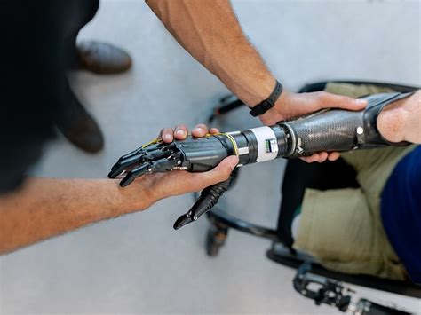 Інвалідність не потрібно встановлювати в Україні спростили процедуру протезування для