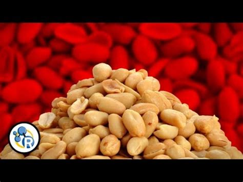 The Truth About Peanut Allergies Instructional Video For 9th Higher