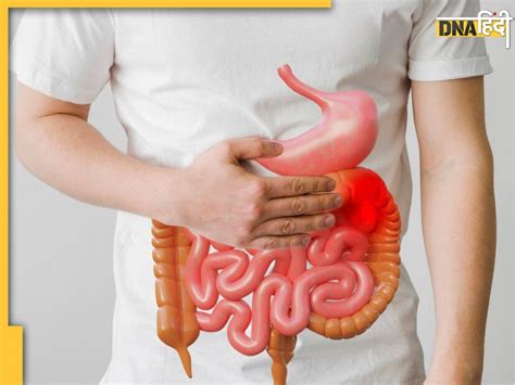 Stomach Problems ब्लोटिंग उल्टी समेत ये लक्षण पेट से जुड़ी इस गंभीर