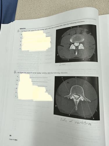 Thorax Cross Sectional Diagrams Flashcards Quizlet