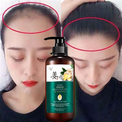 Natural Hair Growth Shampoo Ginger Anti Hair Loss Shampoo 500ml Rambut