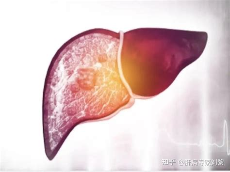 医生提醒：体检时，注意乙肝两对半（乙肝五项）的检查，别忽视 知乎