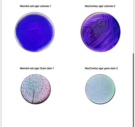 Solved Gram Negative Possibilities Interpretation Of Results