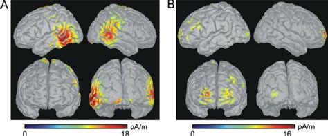 Estimated Distribution Of Cortical Eeg Sources A Source Download Scientific Diagram