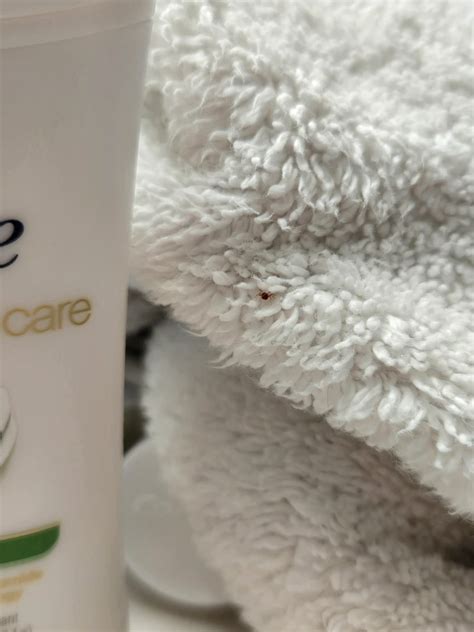 Spider Or Spider Mite Album On Imgur