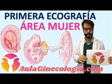 Descubre Todo Sobre La Primera Ecografía Qué Esperar Y Por Qué Es