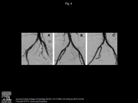 Peripheral Angiography Views And Technique Ppt Download