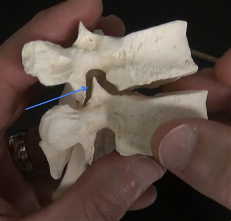 Thoracic Vertebrae Lab Flashcards Quizlet