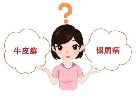牛皮癣的症状表现有哪些 知乎