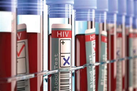 A Third Person May Have Become HIV Free After A Bone Marrow Transplant