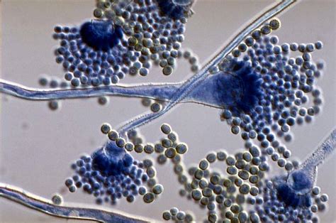 Opiniones De Aspergillus Flavus