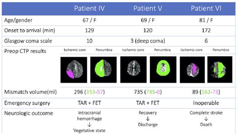 Summary Of Characteristic Of 3 Patients With Preoperative Computed