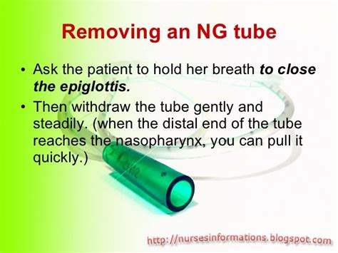 Nasogastric Tube Ngt Insertion And Removal