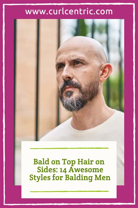 26 Best Bald On Top Hair On Sides Ideas Stylish Haircuts Balding
