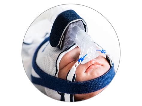 Cpap Continuous Positive Airway Pressure ΔΕΛΤΑ ΙΑΤΡΙΚΗ