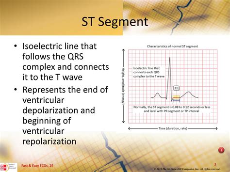 PPT ST Segments T Waves QT Intervals And U Waves PowerPoint Presentation ID 7068789