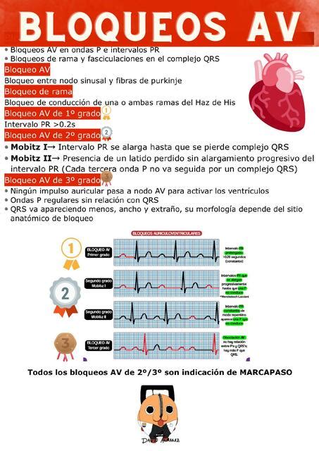 Bloqueos AV UDocz