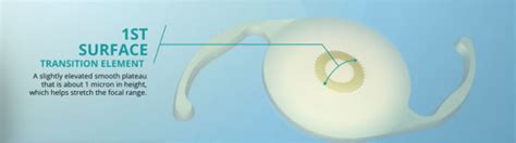 Cataract Surgery Los Angeles Vivity Intraocular Lens Colvard Kandavel