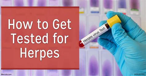 How To Get Tested For Herpes