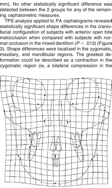 Thin Plate Spline Tps Graphical Display Of Shape Differences Between