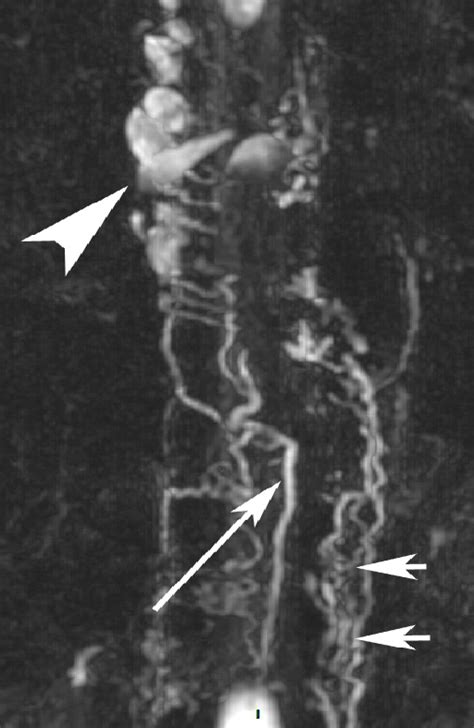 Reconstruction Views By T2 Weighted Magnetic Resonance Imaging