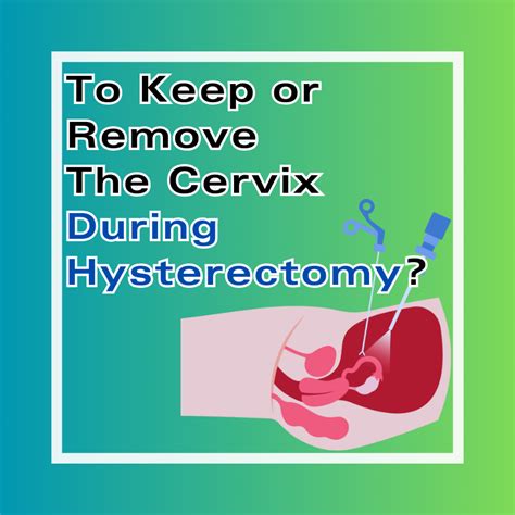 To Keep Or Remove The Cervix During Hysterectomy Understanding Your