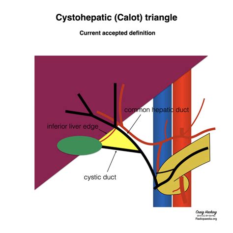 Triangle Of Calot Anatomy And Embryology Of The Biliary Tract
