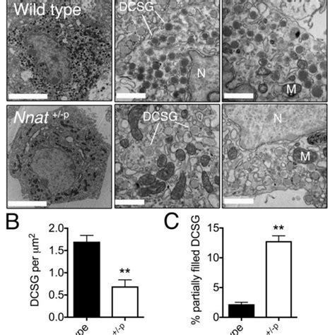 Insulin Secretory Granule Morphology In Nnat Deficient Beta Cells By Em
