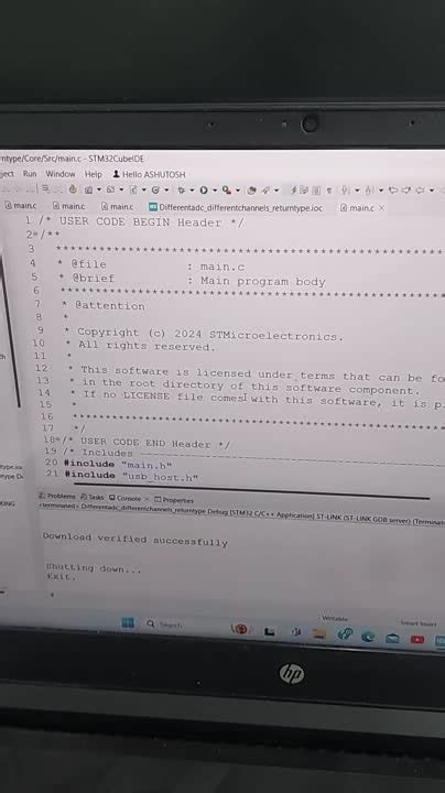 Ashutosh Dehury On Linkedin Stm32 Microcontroller Programmingproject