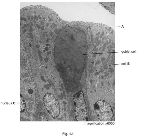 A Level Biology 1 1 The Microscope In Cells Study Exam Style Question