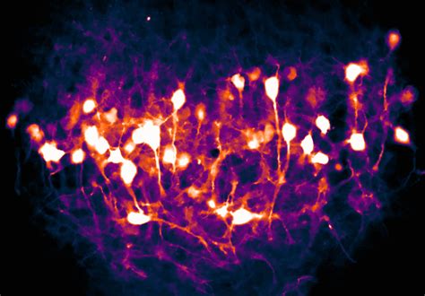 Anxiety Is Innately Coded By A Hippocampal Hypothalamic Neural Circuit