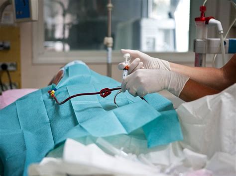 Central Venous Catheters Purpose Types Procedure And More