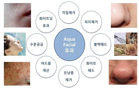 천안아쿠아필 피부관리 깨끗한 모공관리 천안 다나피부과 다나의이야기 다나의원