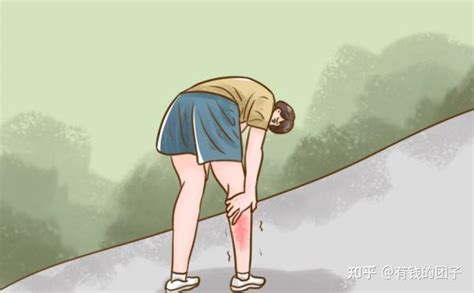 创伤伤口防留疤治疗药物有什么？ 知乎