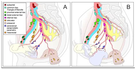 Schematic Diagram Of Pelvic Lymph Node Compartments Mediolateral View