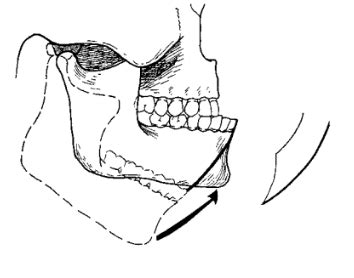 Tmj Muscles Of Mastication Flashcards Quizlet