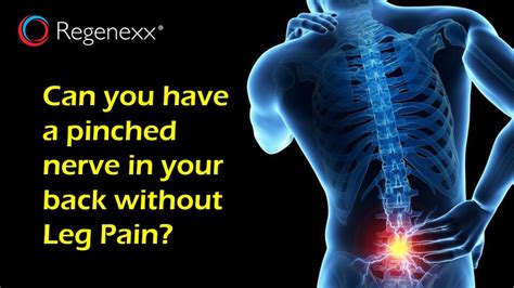 Pinched Low Back Nerve