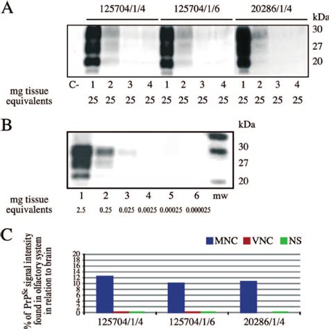 A Detection Of Prp Sc By Highly Sensitive Wb Analysis In The Brain Download Scientific