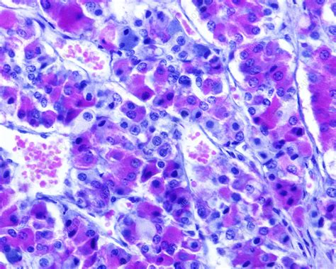 Human Pituitary Gland Light Micrograph Stock Image C0599278