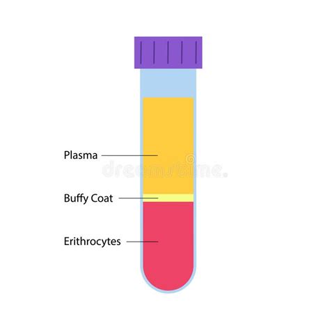 富血小板血浆 向量例证 插画 包括有 骨关节炎 射入 微生物学 等离子 血小板 离心机 人力 220280573