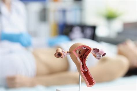 Ovulation Induction Femcare