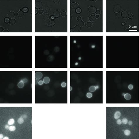 Decapping Enzyme Localization And Hierarchy A Subcellular Localization