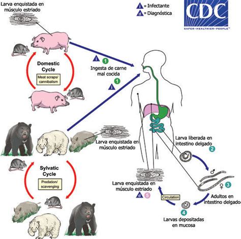 Trichinellosis Mind Map