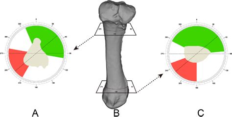 Safety Zone And Danger Zone In Tibia Treatment Green Indicates Safety